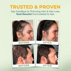 10,000 mcg biotin dosage