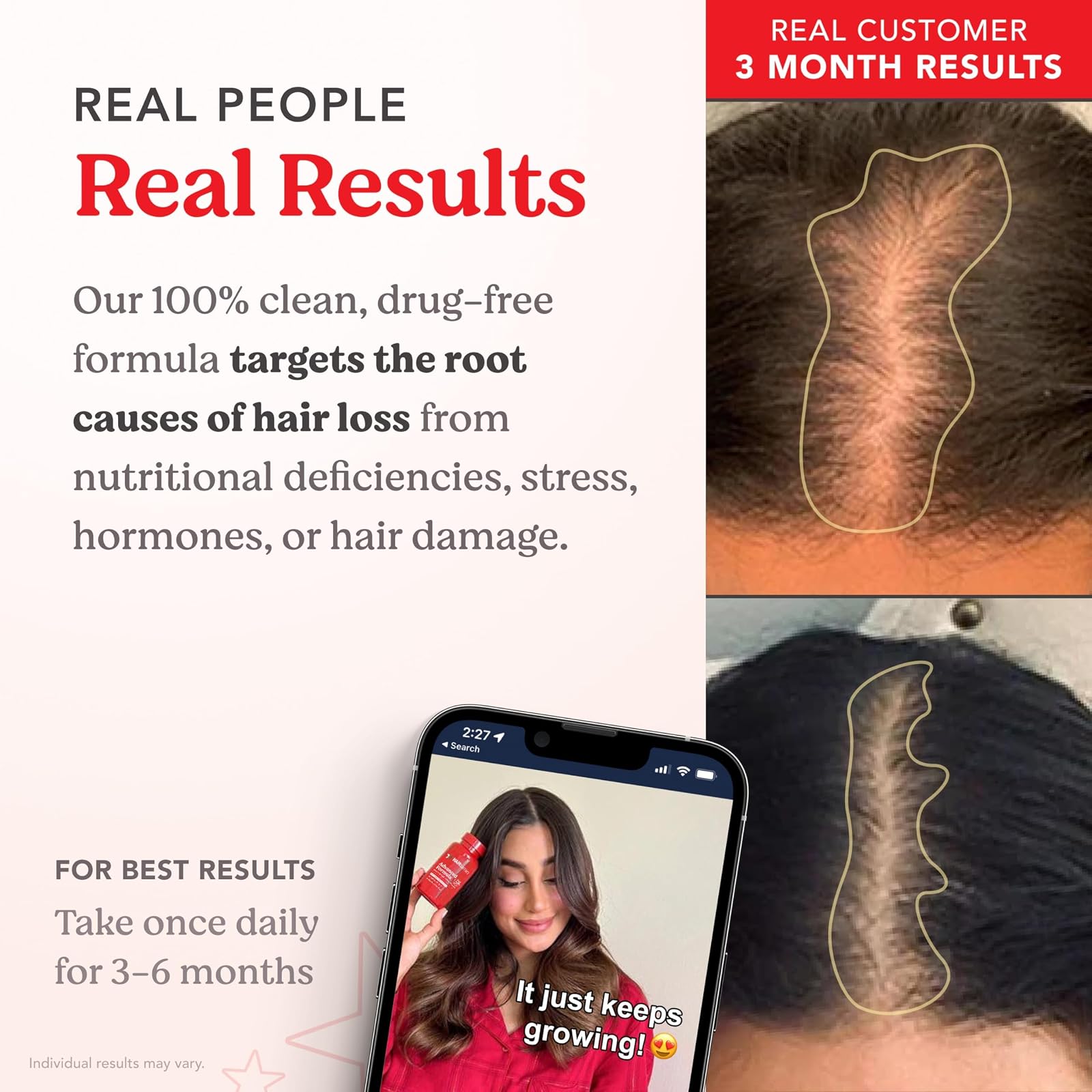 10000 mcg biotin for growth