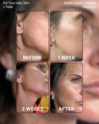 2500 mg collagen for beauty