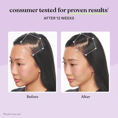 30-day supply of hair vitamins