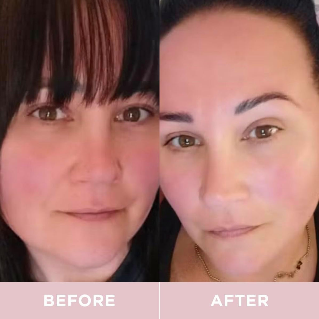 5000 mg collagen for skin health