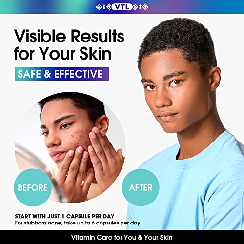 60 blended supplements for acne control