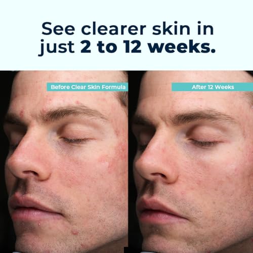 acne-fighting vitamin and mineral blend