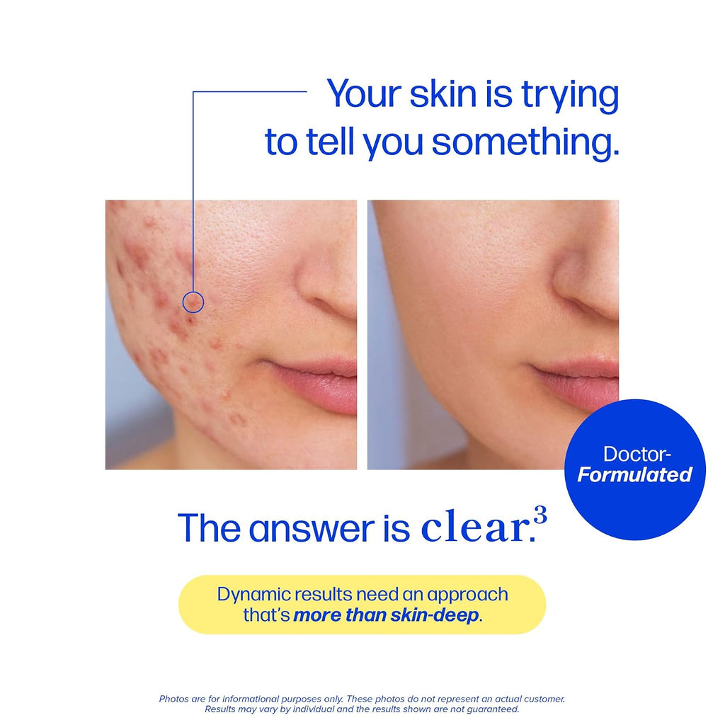 acne support with zinc minerals