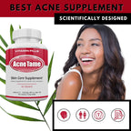 Acnetame 180 tablets for acne