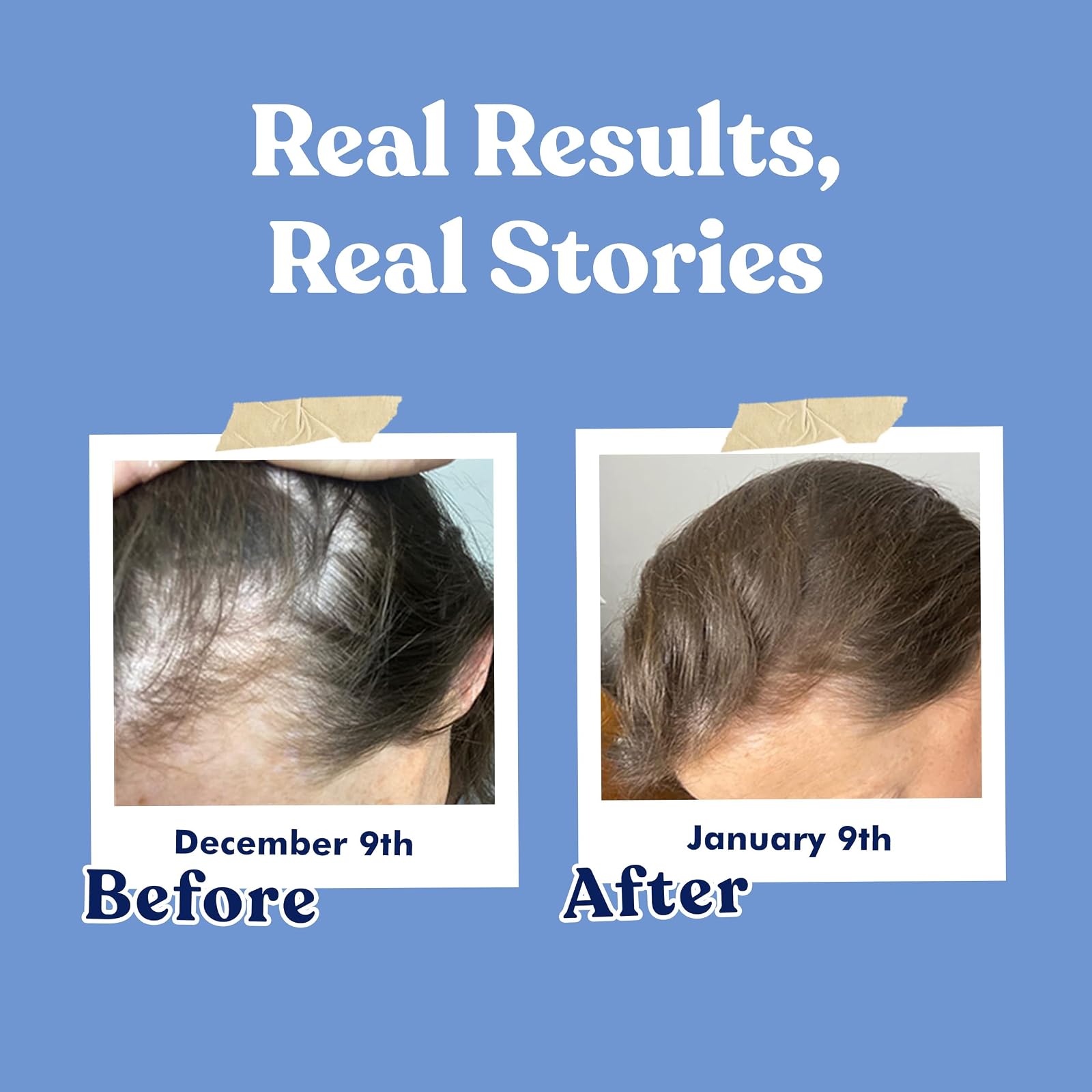 American Standard biotin supplement