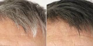 anti-aging supplement with herbal ingredients