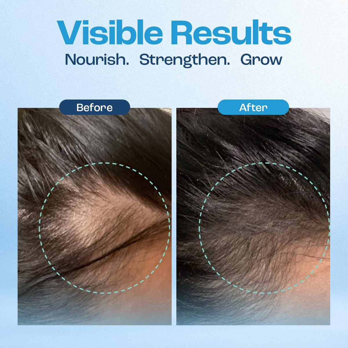Baby Blues hair loss vitamins