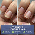 Beauty vitamins for stronger nails