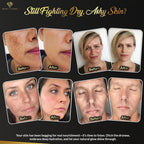 Beef tallow cream for youthful skin appearance