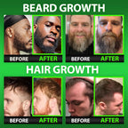 best beard vitamins with biotin