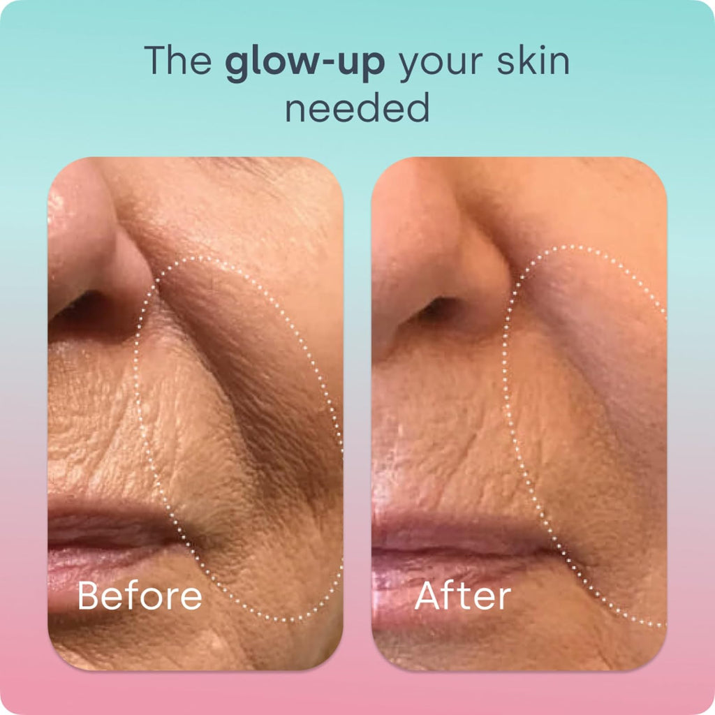Biosil Skin Renew anti-aging formula