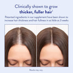 biotin capsules for stronger hair