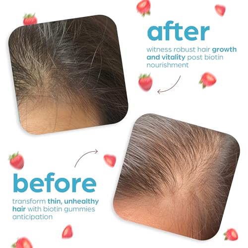 biotin gummies for healthy hair growth