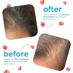 biotin gummies for healthy hair growth