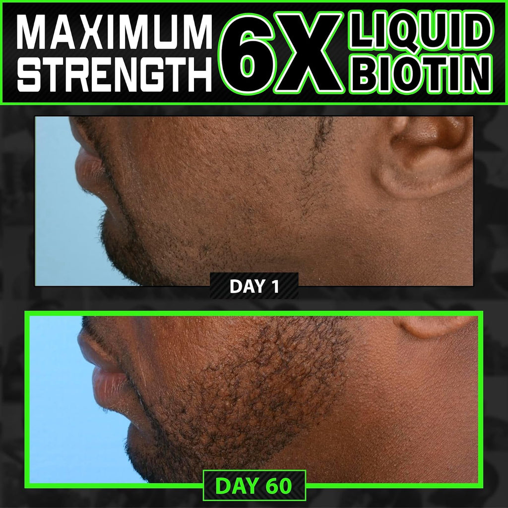 biotin supplement for stronger nails