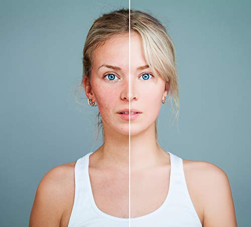 blended supplements for skin clarity