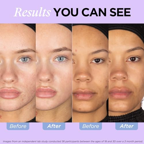 blended vitamins for acne-prone skin