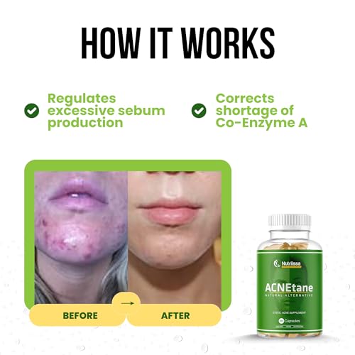blended vitamins for cystic acne relief