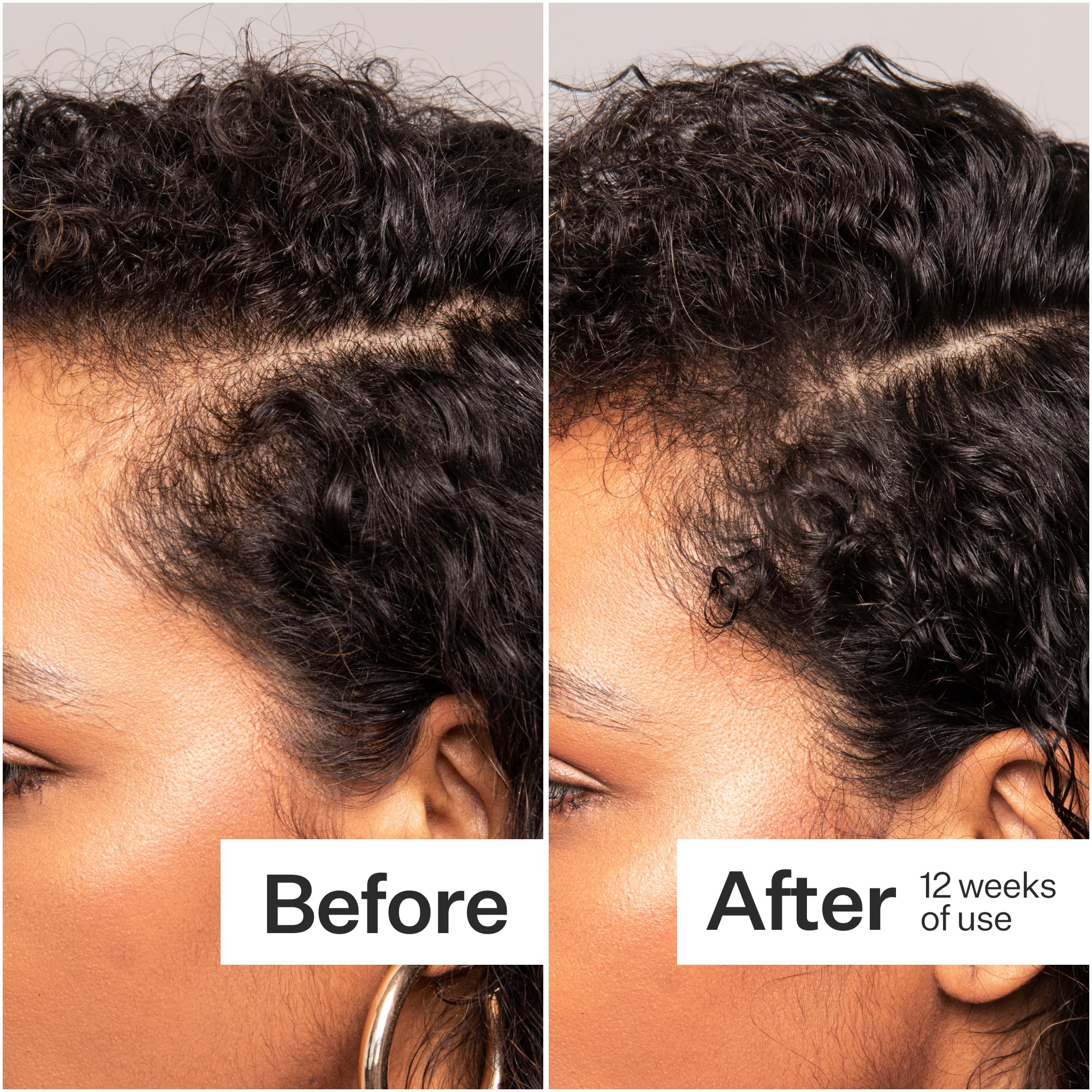blended vitamins for fuller hair