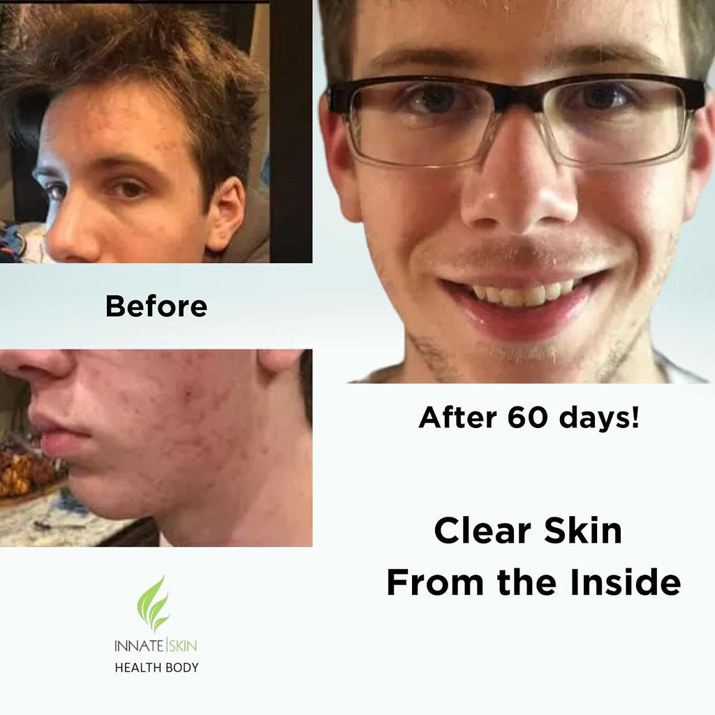 Clear Skin kids multivitamin for growth