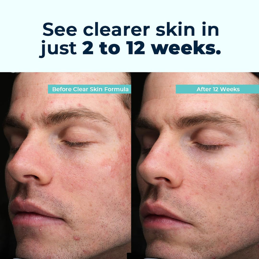 clear skin multivitamin for men
