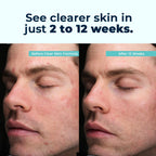 clear skin multivitamin for men