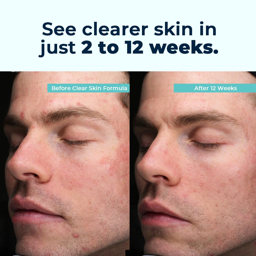 clear skin multivitamin for men