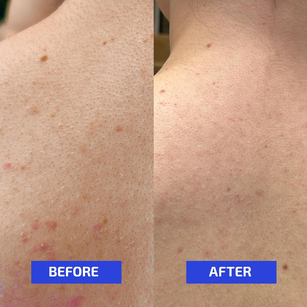 Codex Labs Shaant skin wellness solution