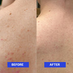 Codex Labs Shaant skin wellness solution