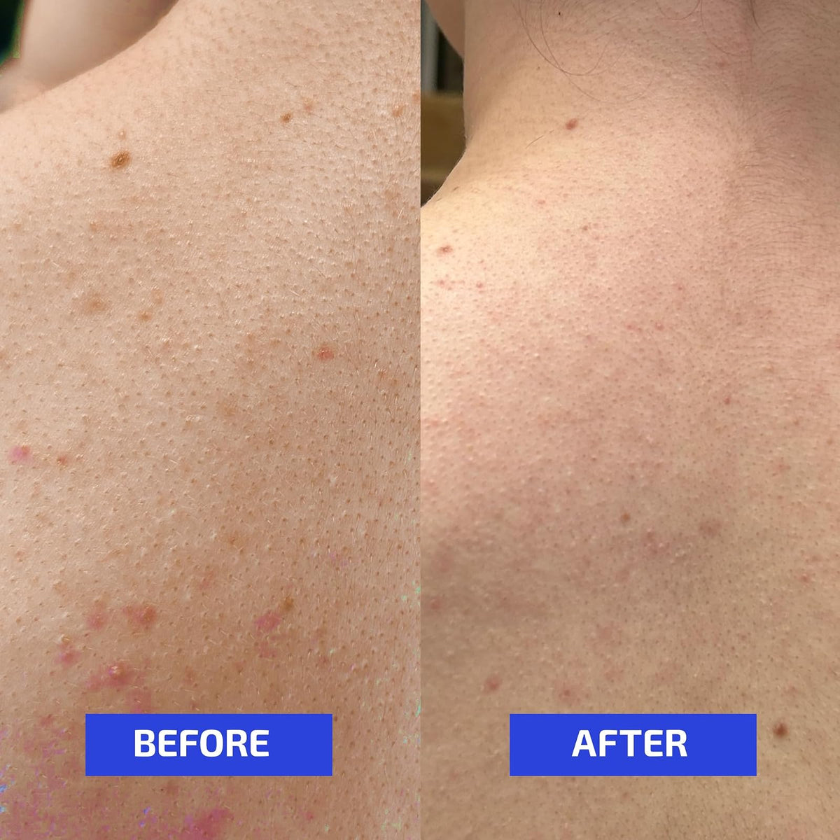 Codex Labs Shaant skin wellness solution