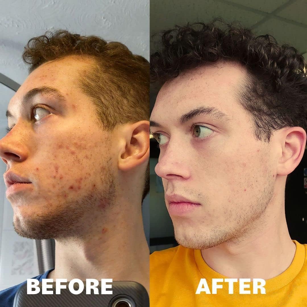 collagen boost for radiant skin