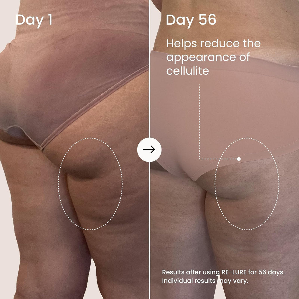 collagen boosting body treatment