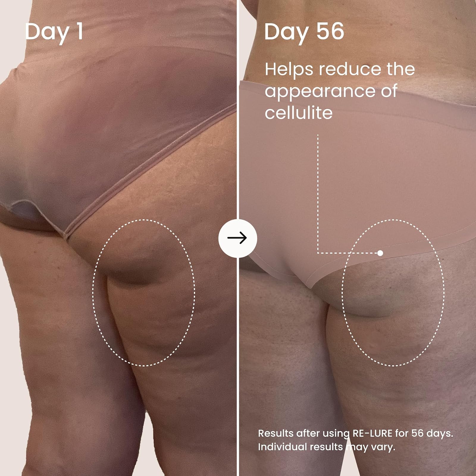 collagen boosting body treatment