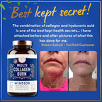 collagen gummies for convenient supplementation