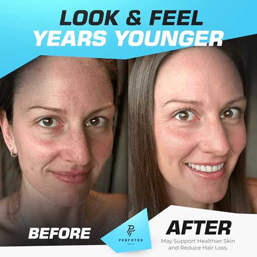 collagen peptides for healthy skin