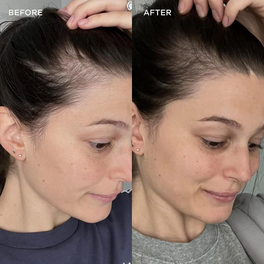 collagen peptides for healthy skin