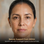 collagen peptides for joint support