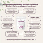 collagen peptides for joint support