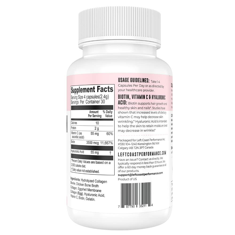 collagen peptides for joint support