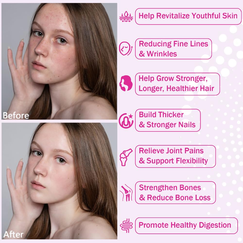 collagen peptides for joint support