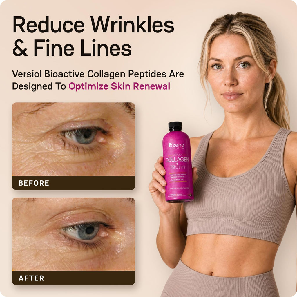 collagen peptides for joint support