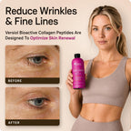 collagen peptides for joint support