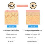 collagen peptides for joint support