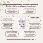 collagen peptides for joint support