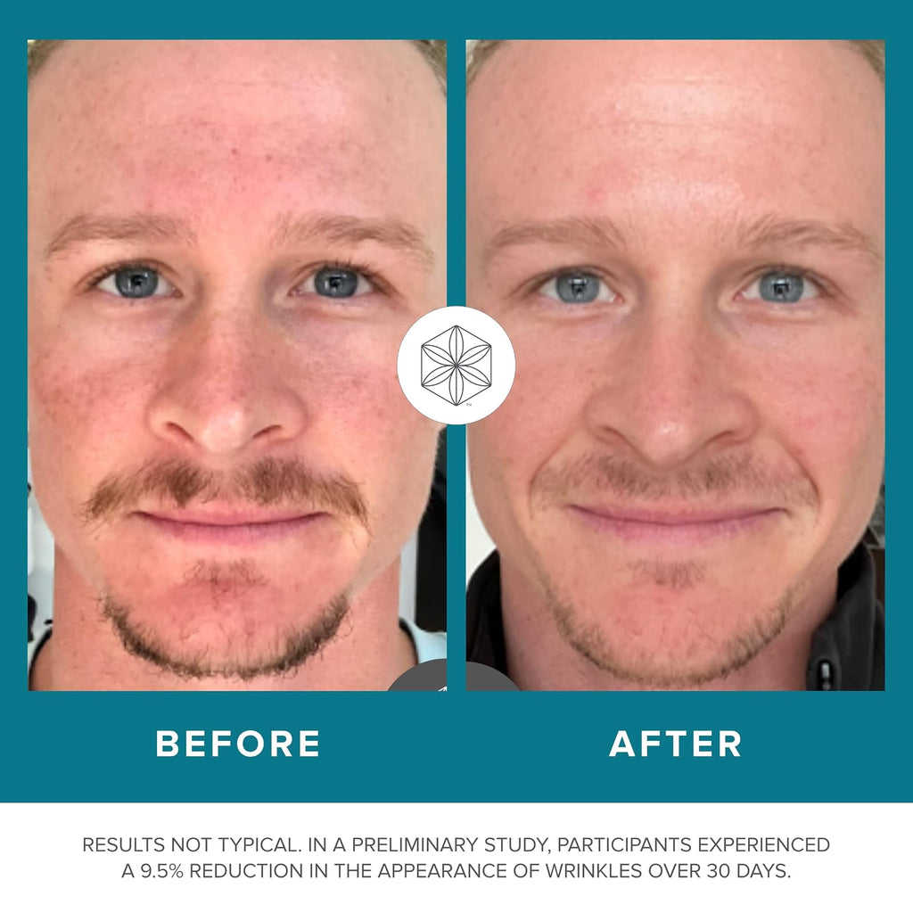 collagen peptides for radiant complexion
