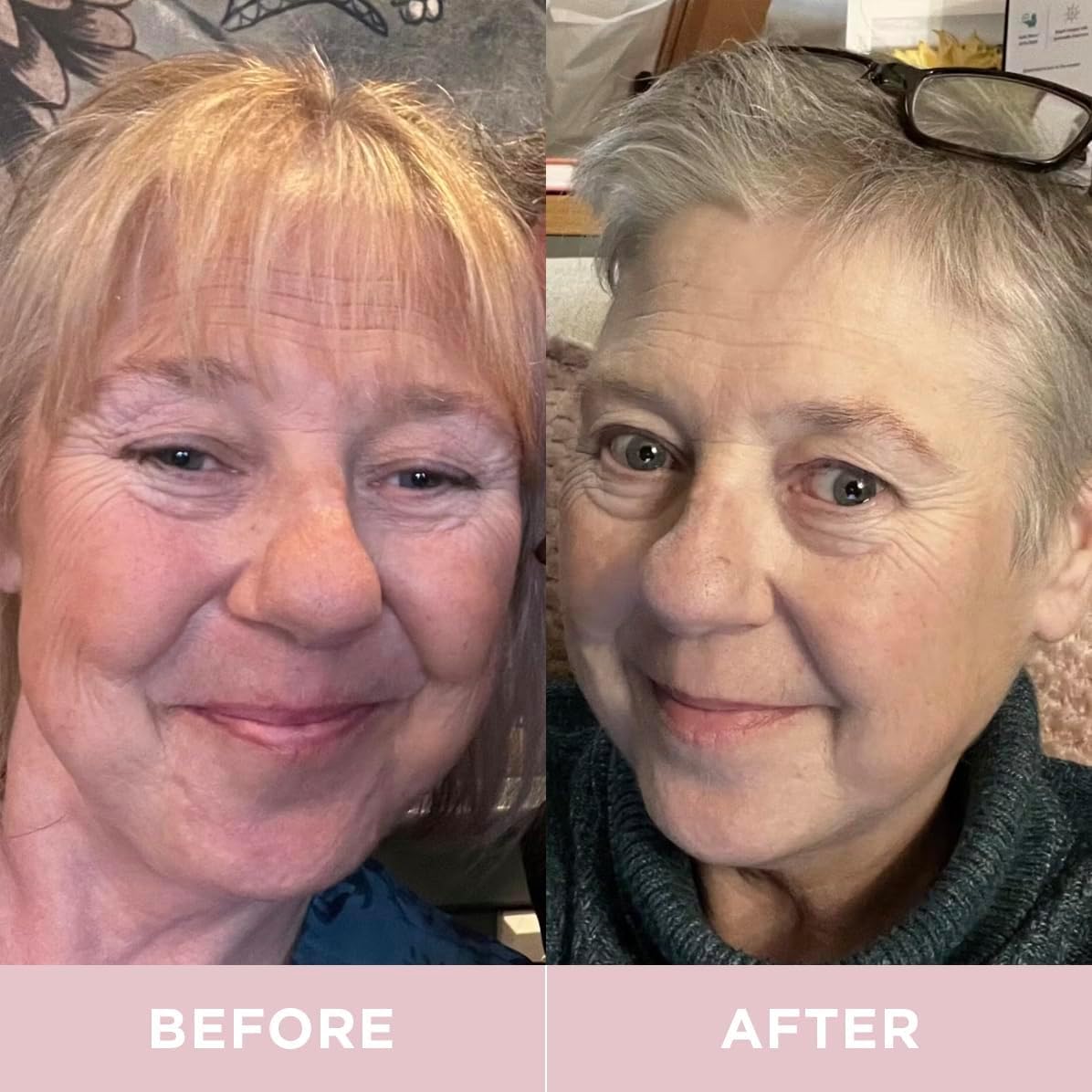 collagen peptides for skin health