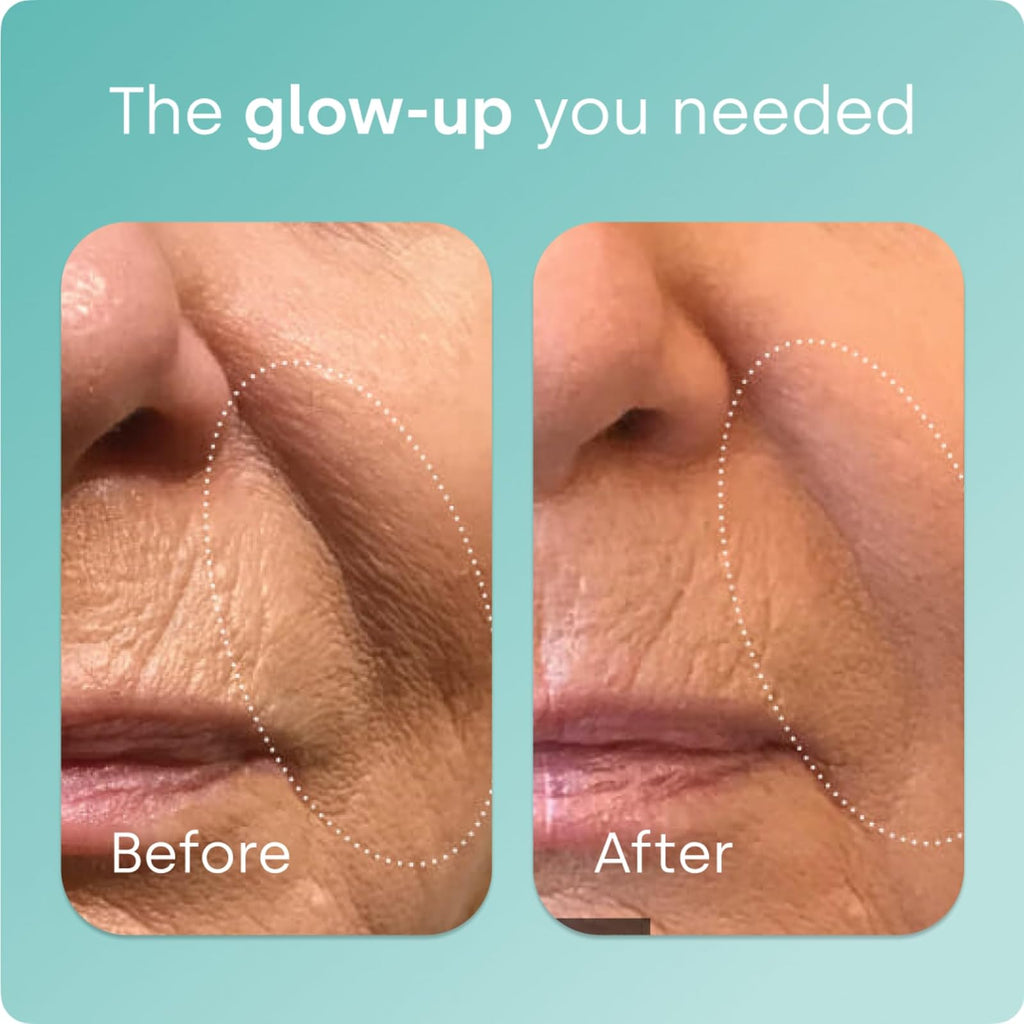 collagen peptides for youthful glow