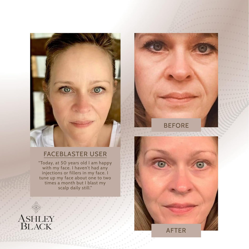 collagen peptides for youthful skin