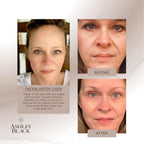collagen peptides for youthful skin